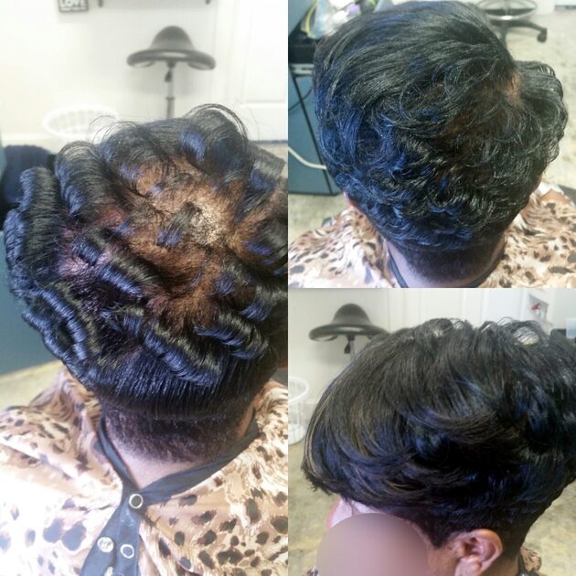 Hair Loss Solutions Rocky Mount - Rocky Mounts Best Hair Studio